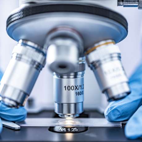 Evotec nach dem Absturz: Droht noch mehr Druck auf die Aktie?